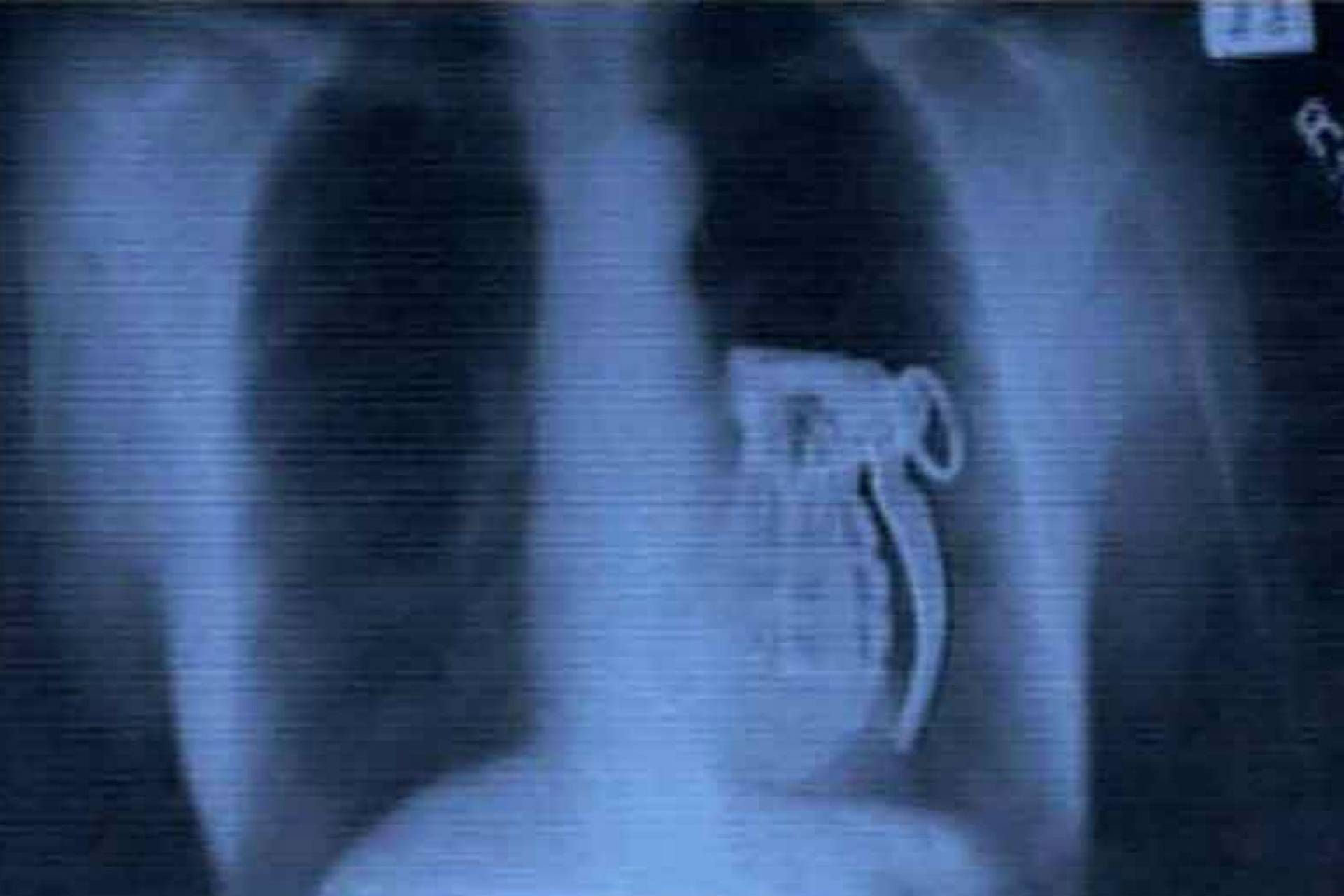 Altro che ingoiare il rospo! Ecco cosa rivelano le radiografie