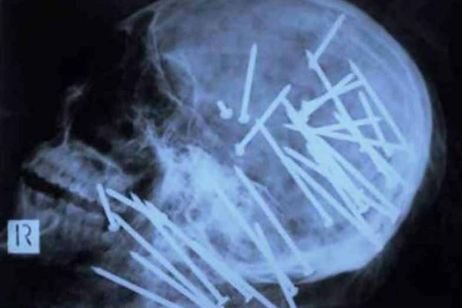 Altro che ingoiare il rospo! Ecco cosa rivelano le radiografie