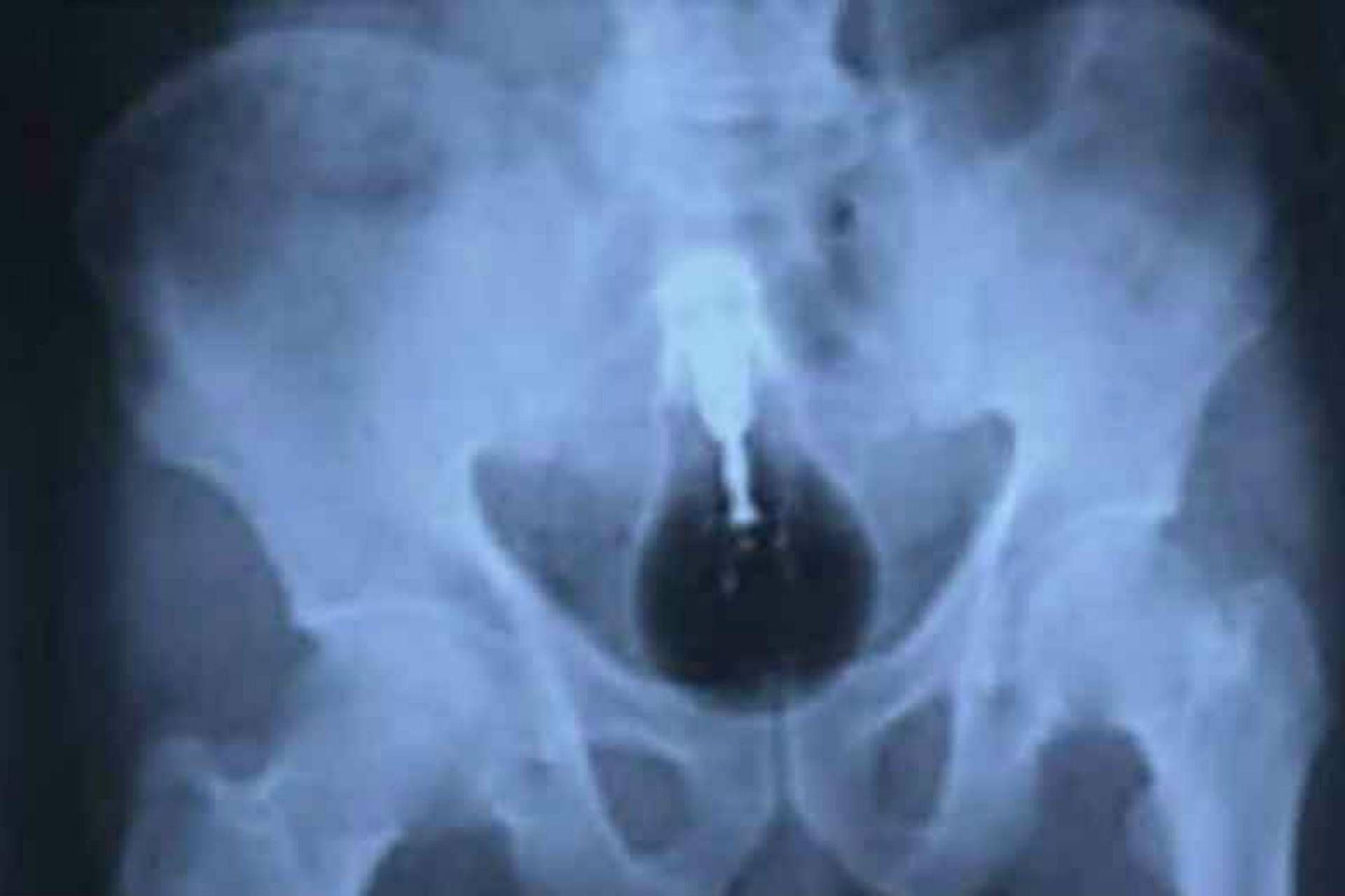 Altro che ingoiare il rospo! Ecco cosa rivelano le radiografie